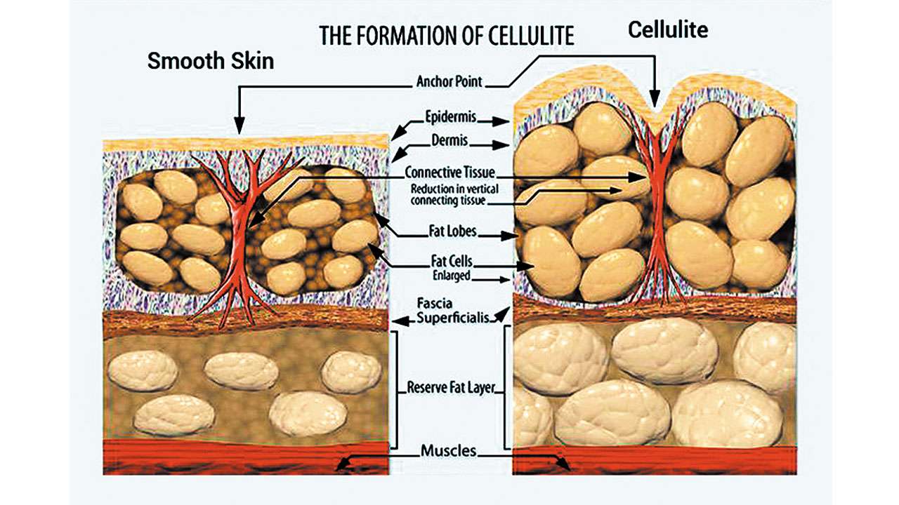 Slimming and Improving Cellulite/ AZABU SKIN CLINIC